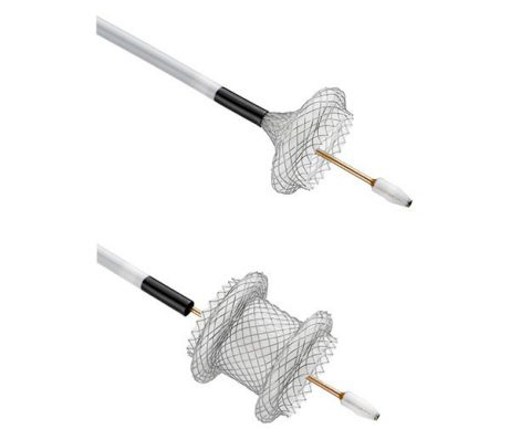 Pioneering Uses of Lumen-Apposing Metal Stents (LAMS) - Brigham On a ...